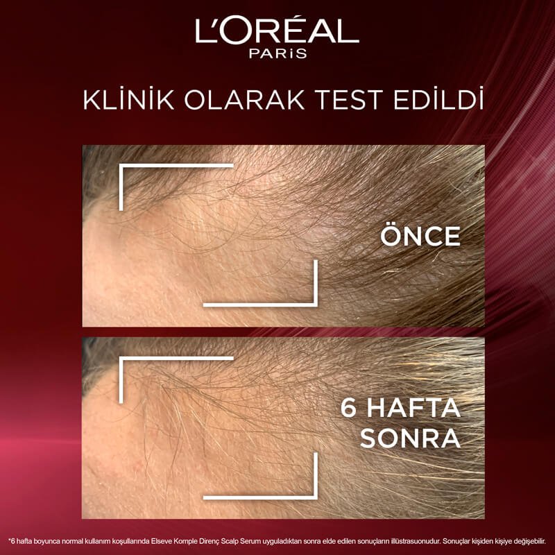 Elseve Komple Direnç Saç Bakımı %1.5 Aminexil [Kafein + Arginine ...